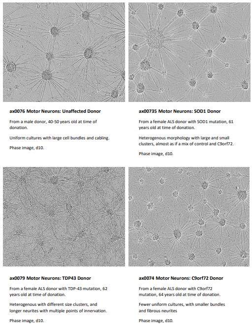 Multielectrode array characterization of human iPSC-derived motor neuron disease model for ALS ...